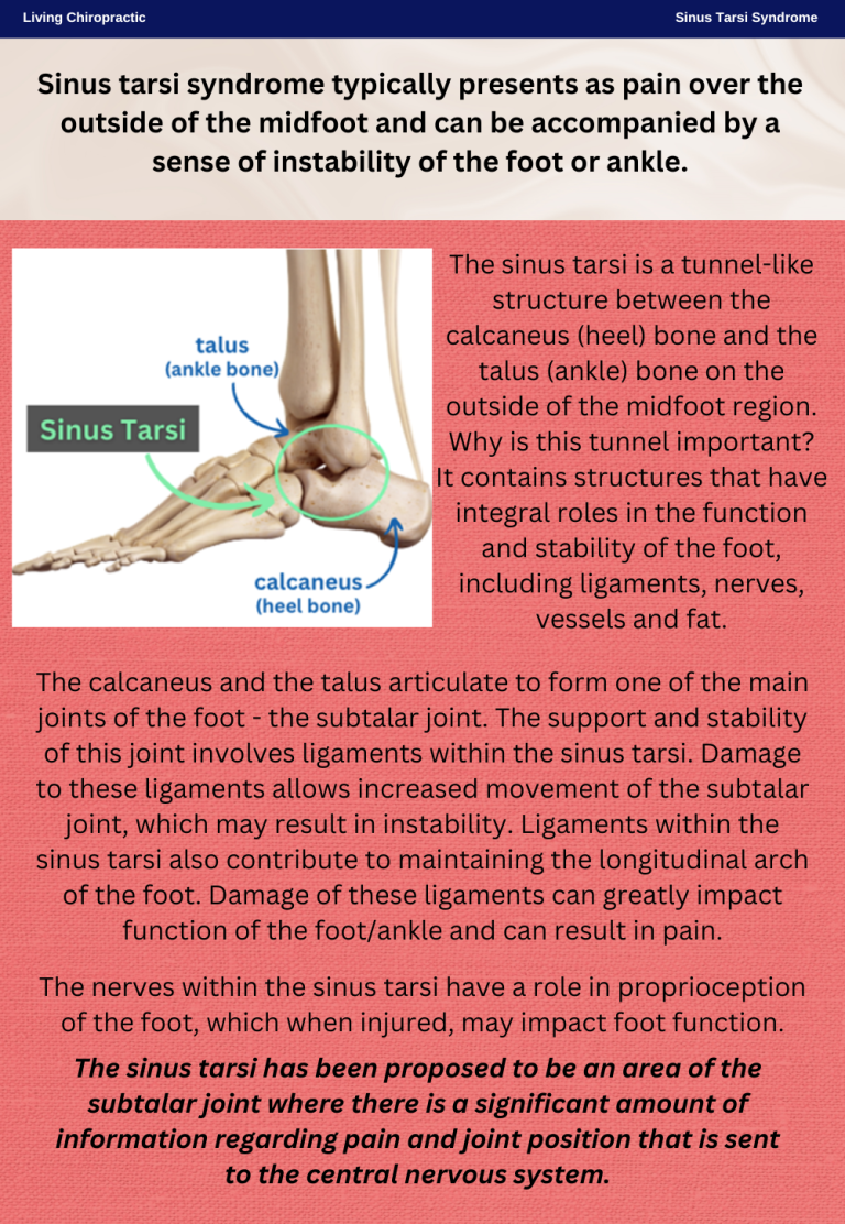 Sinus Tarsi Syndrome - Living Chiropractic
